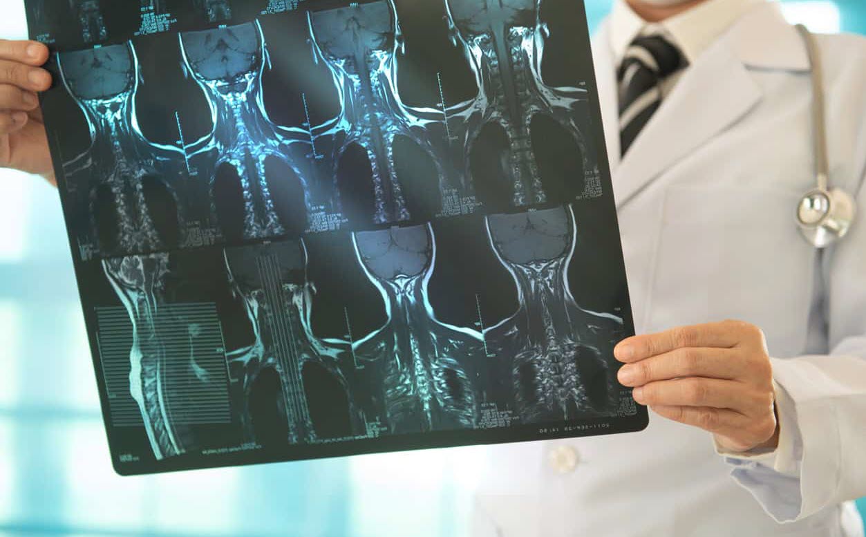 Filing a Lawsuit for Cancer Misdiagnosis | NY Medical Malpractice